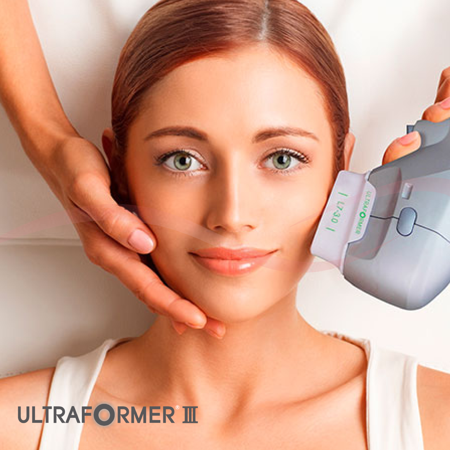 Ultraformer III Lume Laser